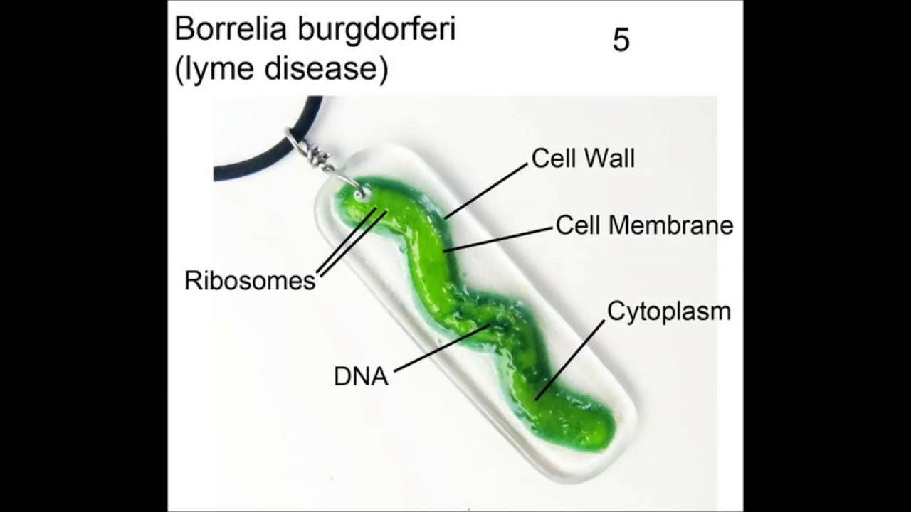 Demonstration: How Lyme Disease, (spirochetes) Can Be Killed! - YouTube