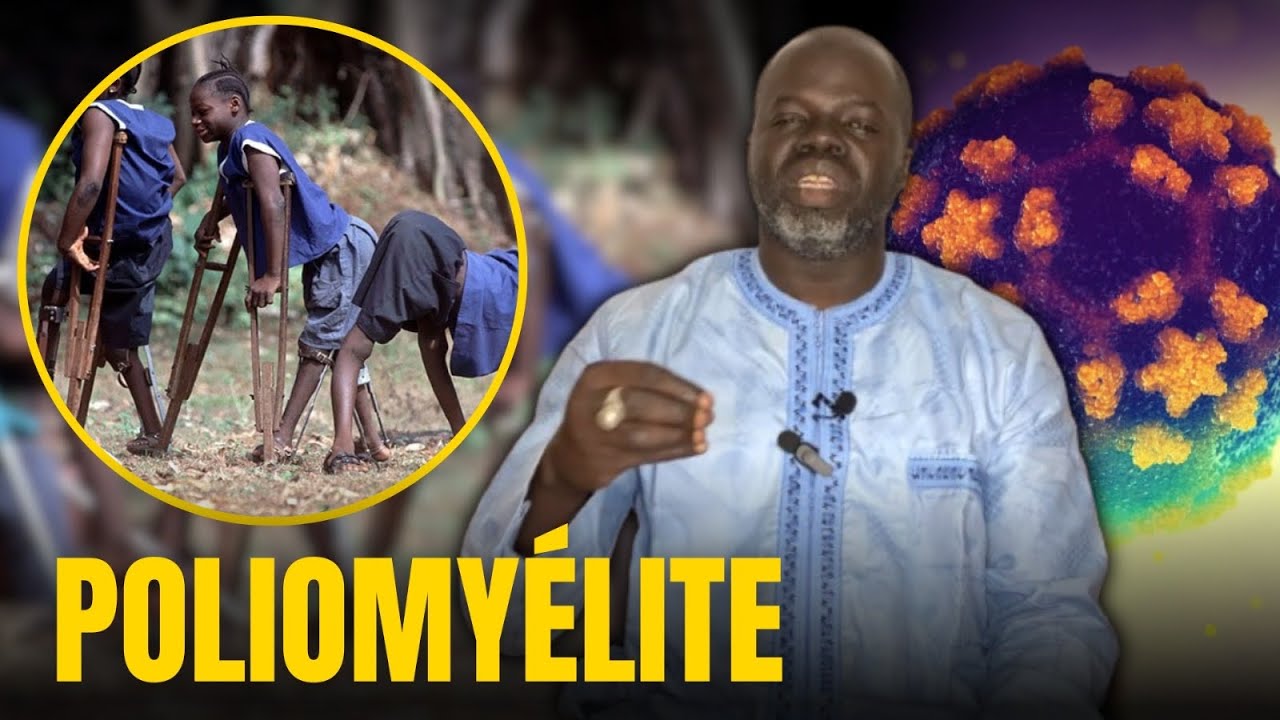 Poliomyélite #1 - ( Causes et Conséquences ) - Pr Ousmane Ndiaye - SAMA ...