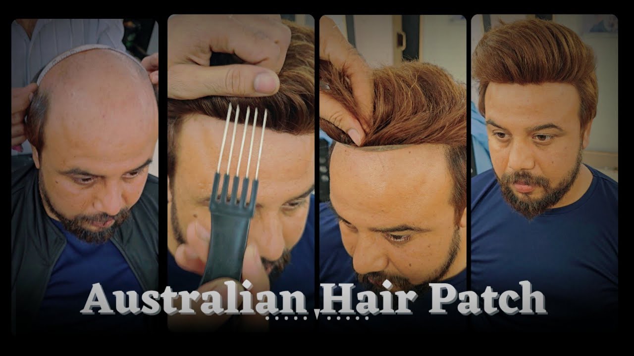 Natural Hair Patch in Bareilly || Natural Hair Patch system || Mirage ...