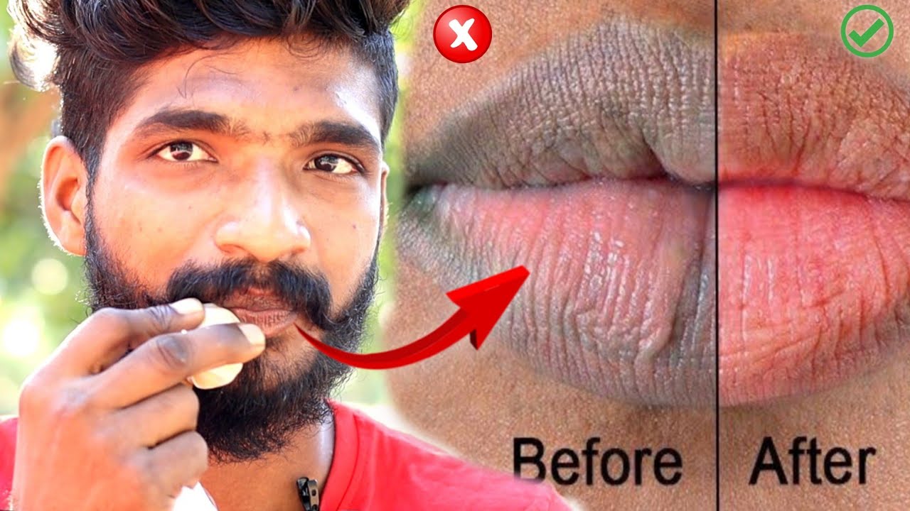 Dark To Pink Lips In 1 MINUTE ( 5 Best Home remedies ) | தமிழ் | - YouTube
