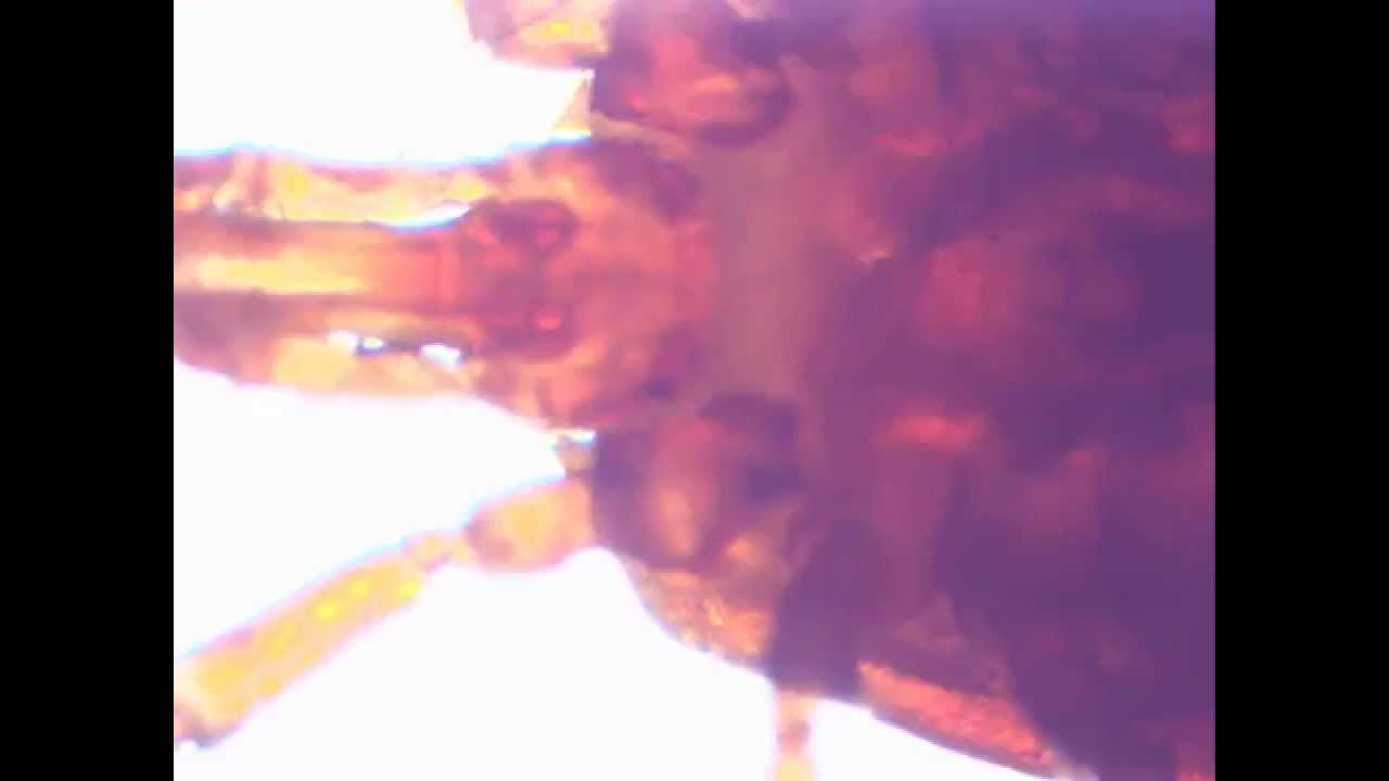 Tick under the microscope - YouTube