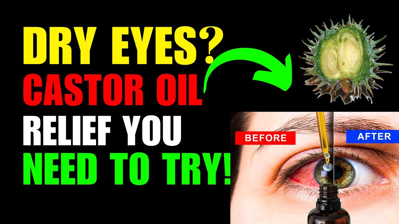Dry Eyes Castor Oil Relief You NEED to Try - YouTube