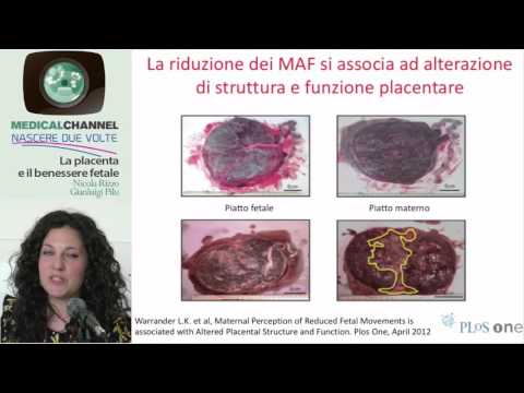 Ridotta percezione dei movimenti fetali