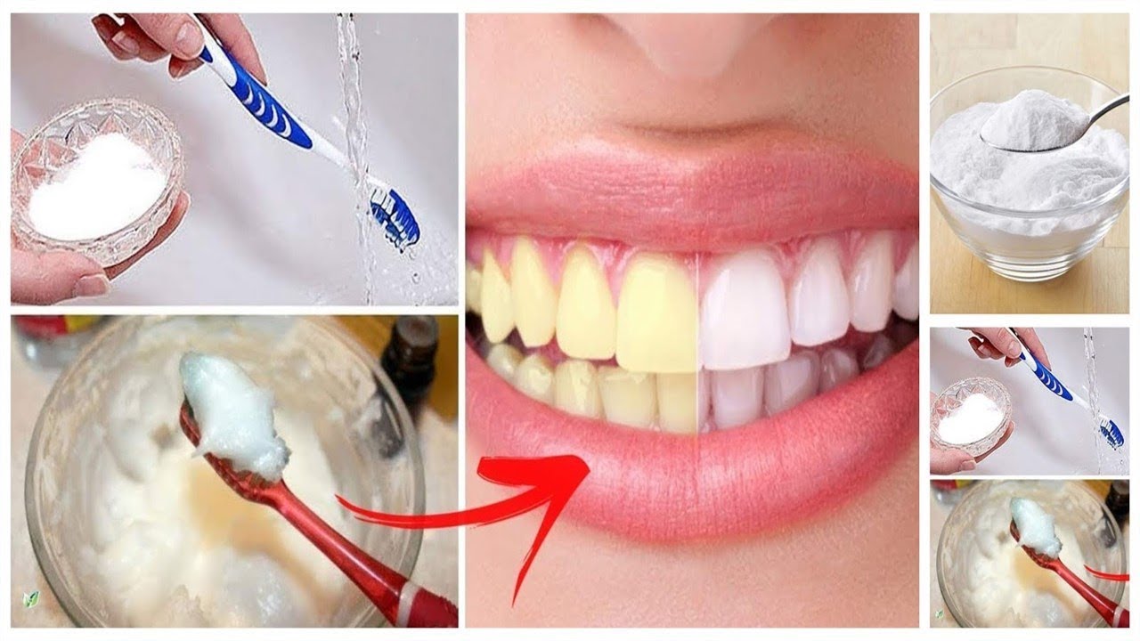 Que Es El Sarro y Como Quitarlo - El Bicarbonato De Sodio Para Quitar ...