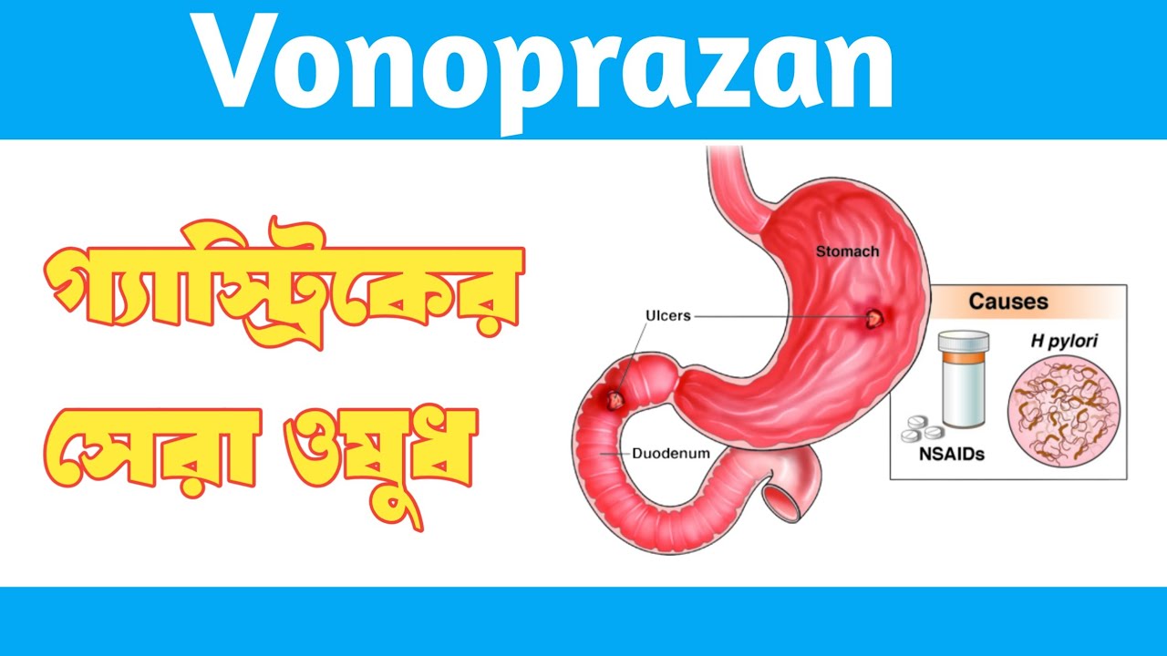 Vonoprazan এর কাজ কি | গ্যাস্ট্রিকের সেরা ওষুধ | Vonomax 20 | Vontack ...