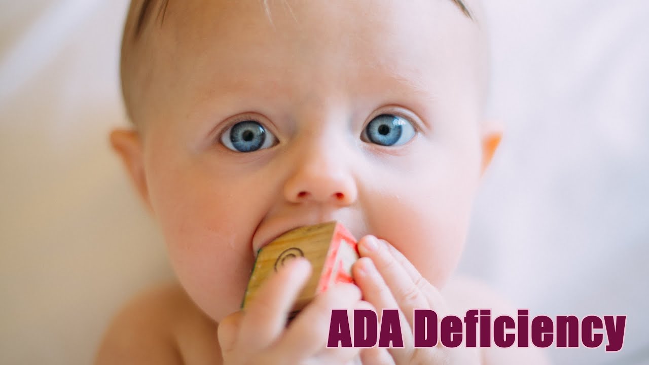 Discovering ADA Deficiency | The Rare Genetic Disorder That Affects the ...