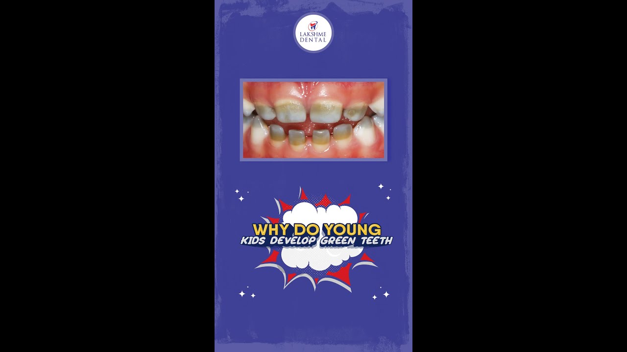 Why do young kids develop green teeth | Green stained teeth | Tooth ...