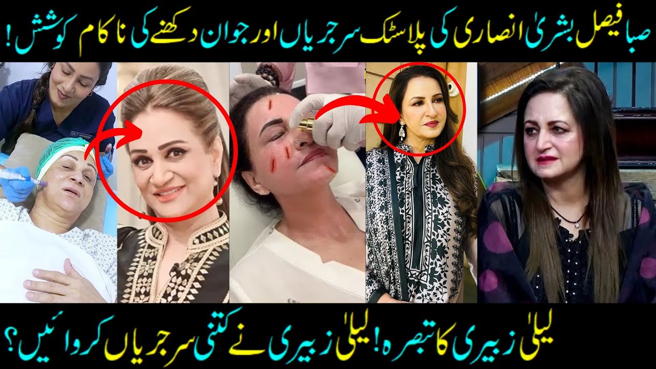 Laila Zuberi's Statement On Bushra Ansari & Saba Faisal Plastic Surggery! #sabihsumair #viral ...