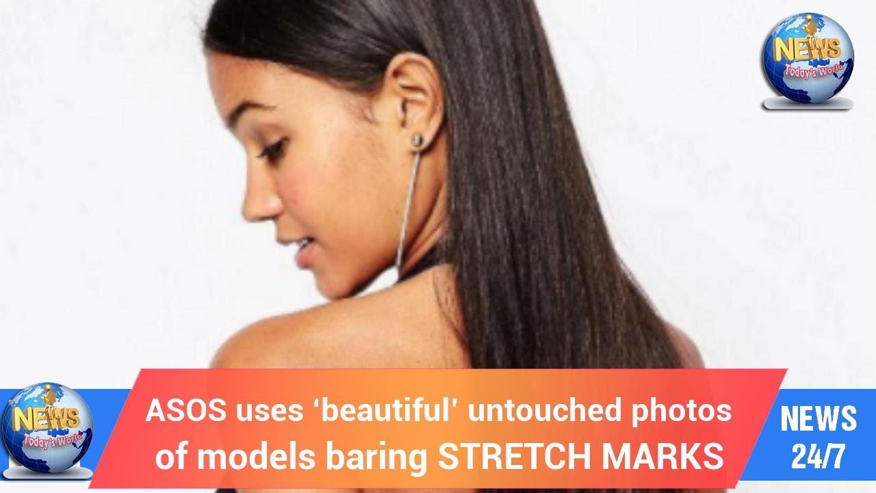 ASOS uses ‘beautiful’ untouched photos of models baring STRETCH MARKS ...