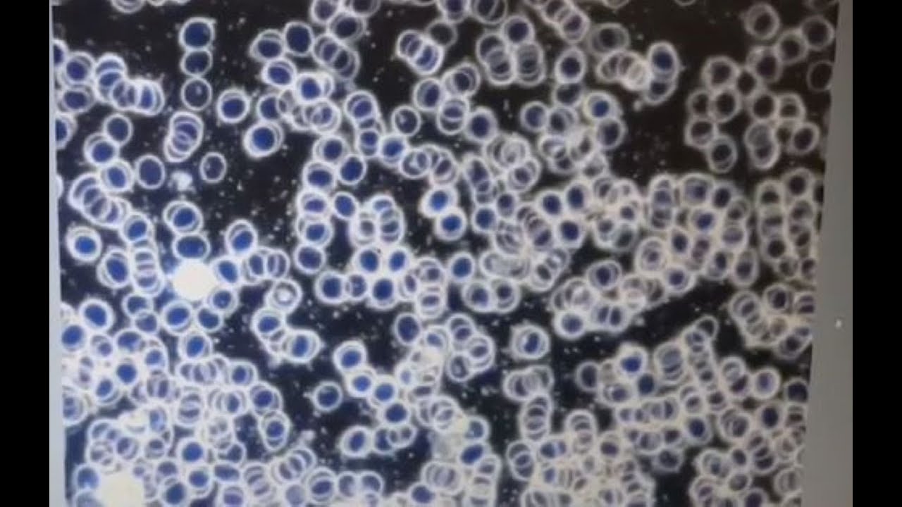 Dark Field Microscopy of Human Blood - YouTube