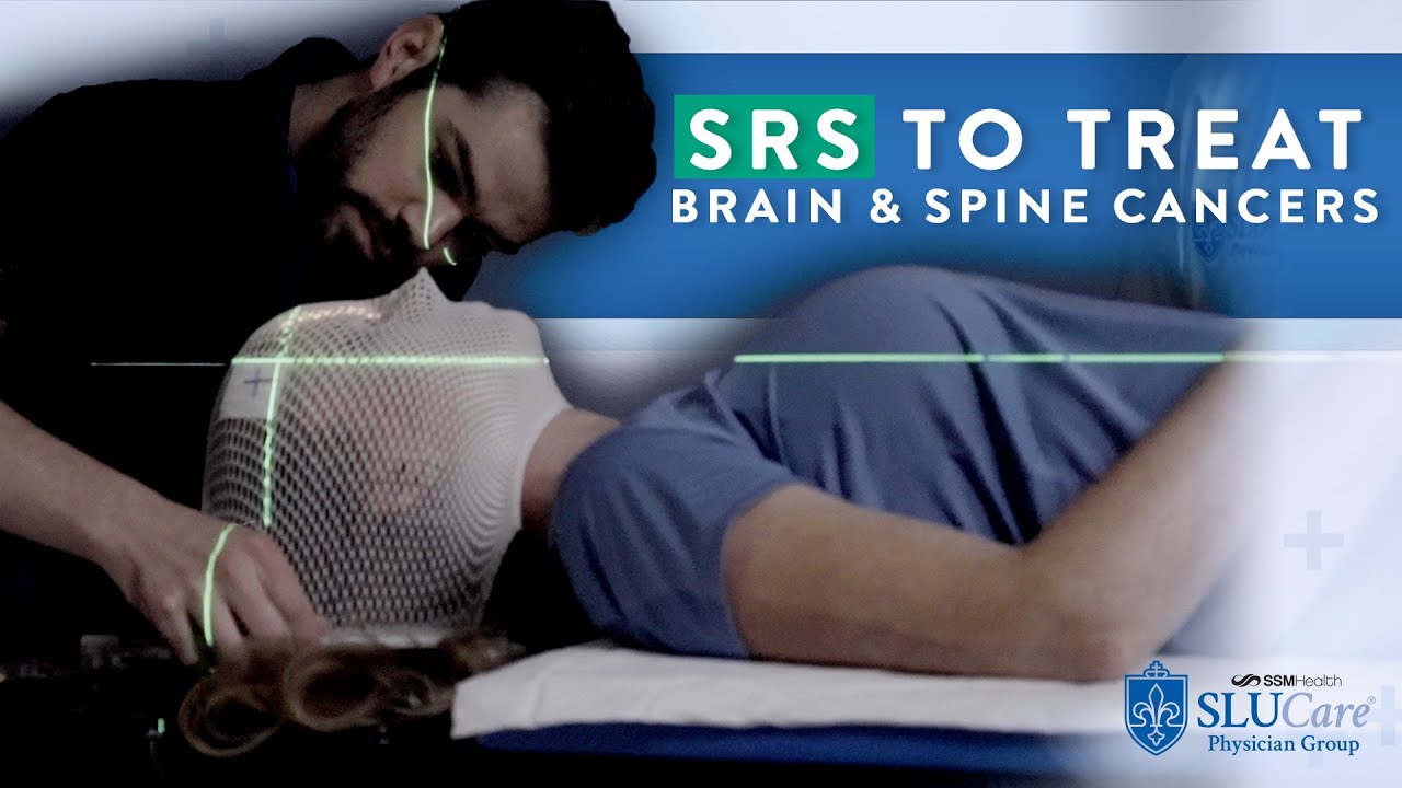 Using SRS for Brain and Spine Cancers - SLUCare Radiation Oncology ...