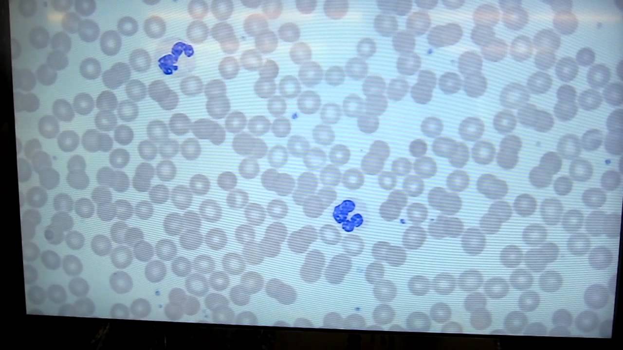 A&P1 Lab#3 blood - YouTube