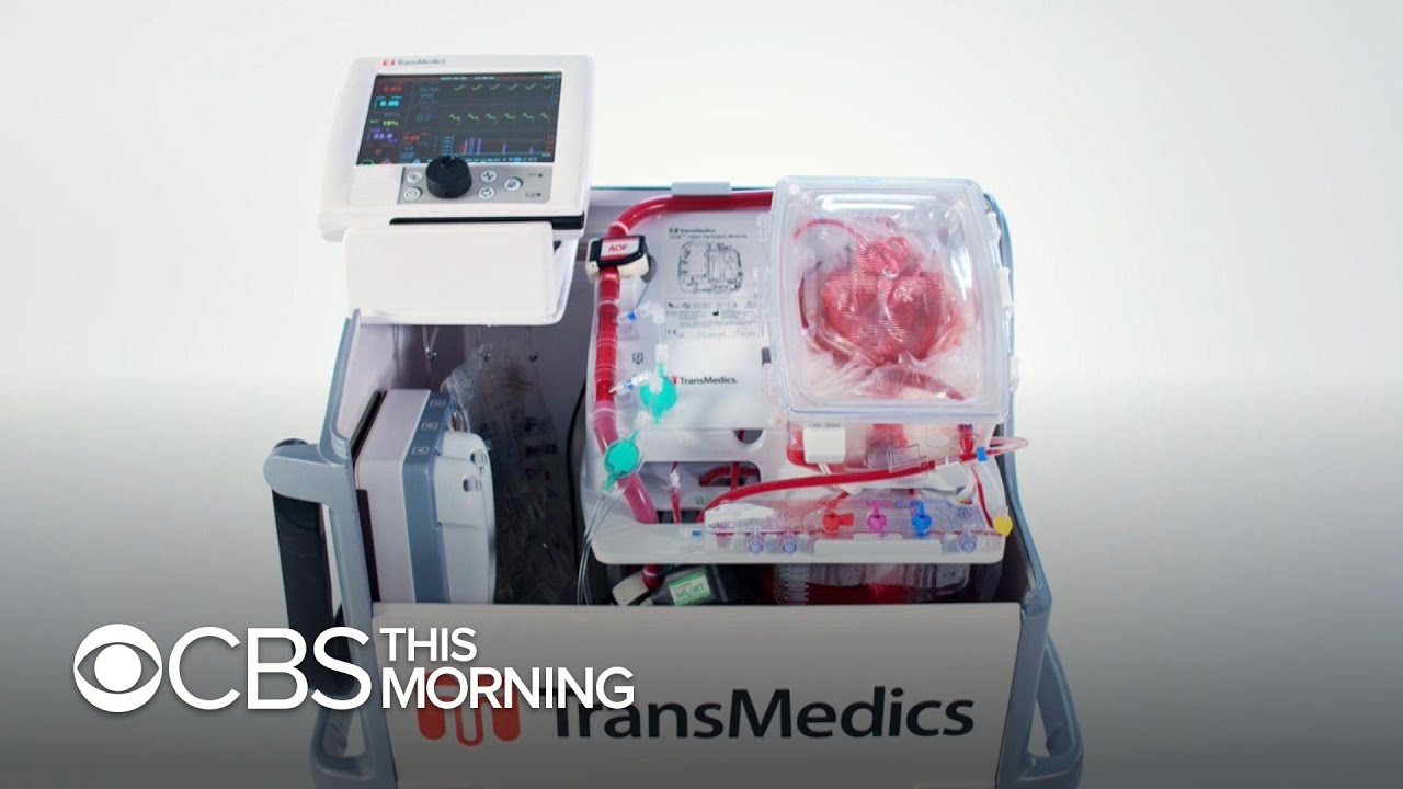 Doctors revive donor heart to perform successful transplant in U.S ...