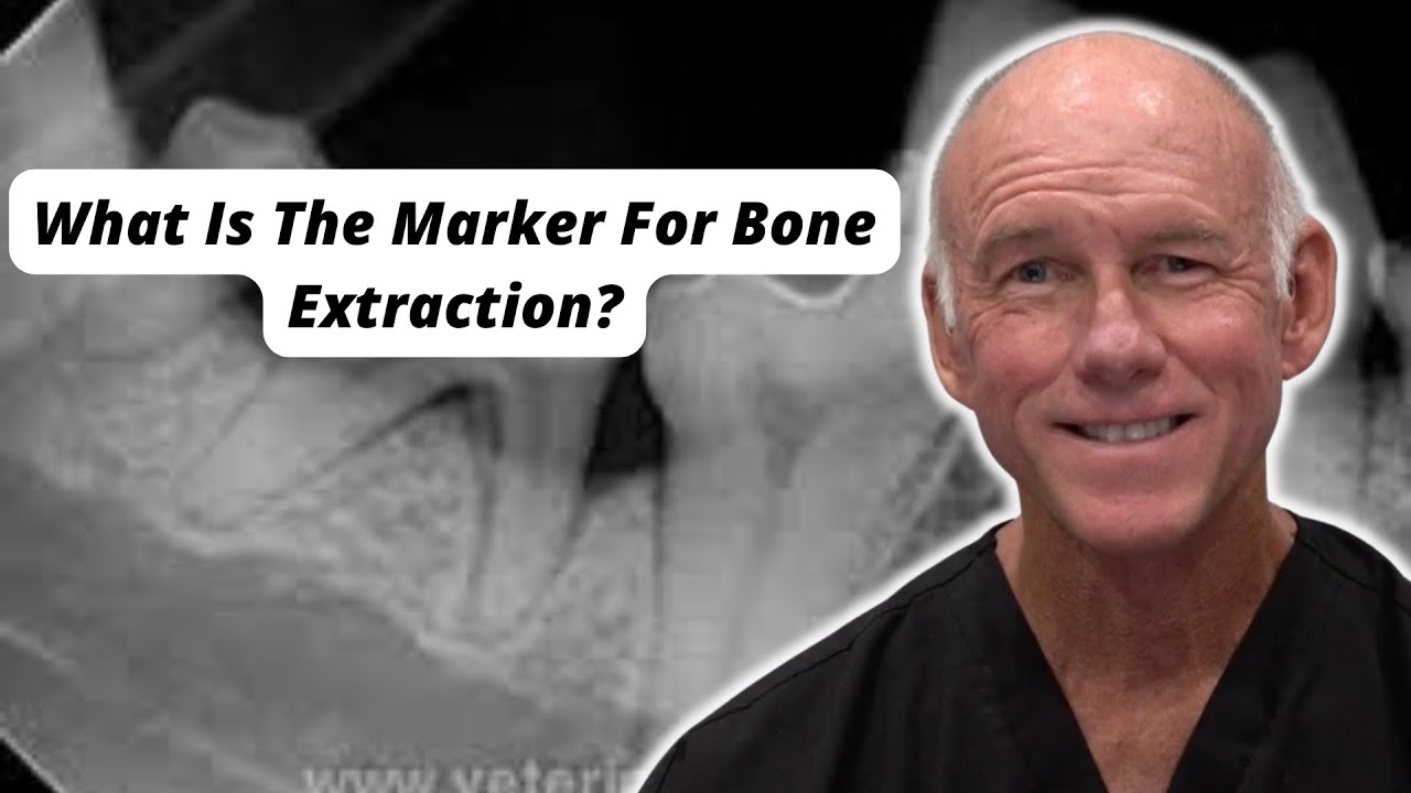 What Is The Marker For Bone Extraction? - YouTube