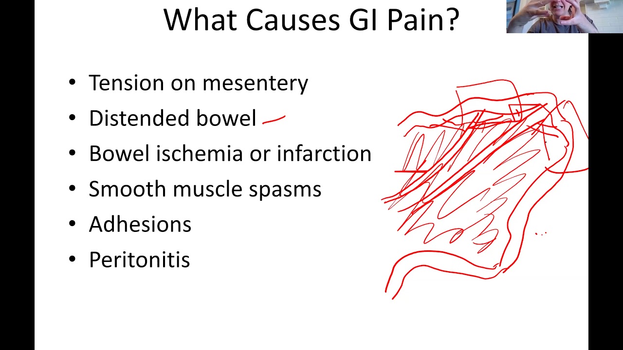 colic in horses: part 2 medical and surgical types of colic - YouTube