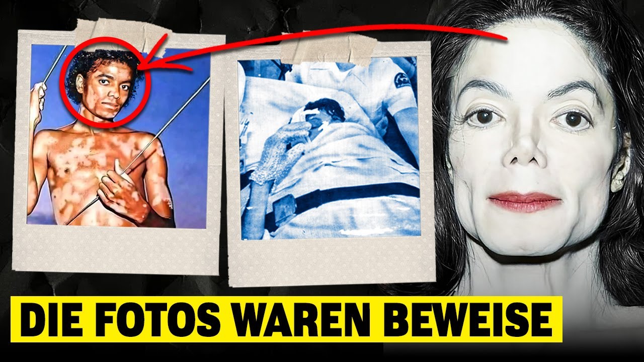 100 Verbotene Fotos Von Michael Jackson, Die Man Ihnen Nie Zeigen ...