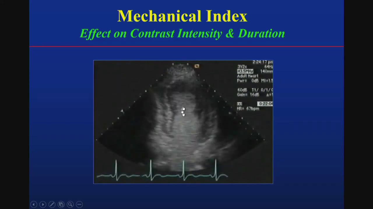 Principles of Contrast Echocardiography - YouTube