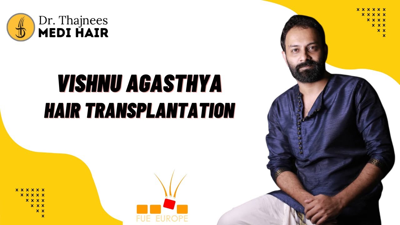 Actor Vishnu Agasthya || 4000 - 4500 Grafts procedure || Hair ...