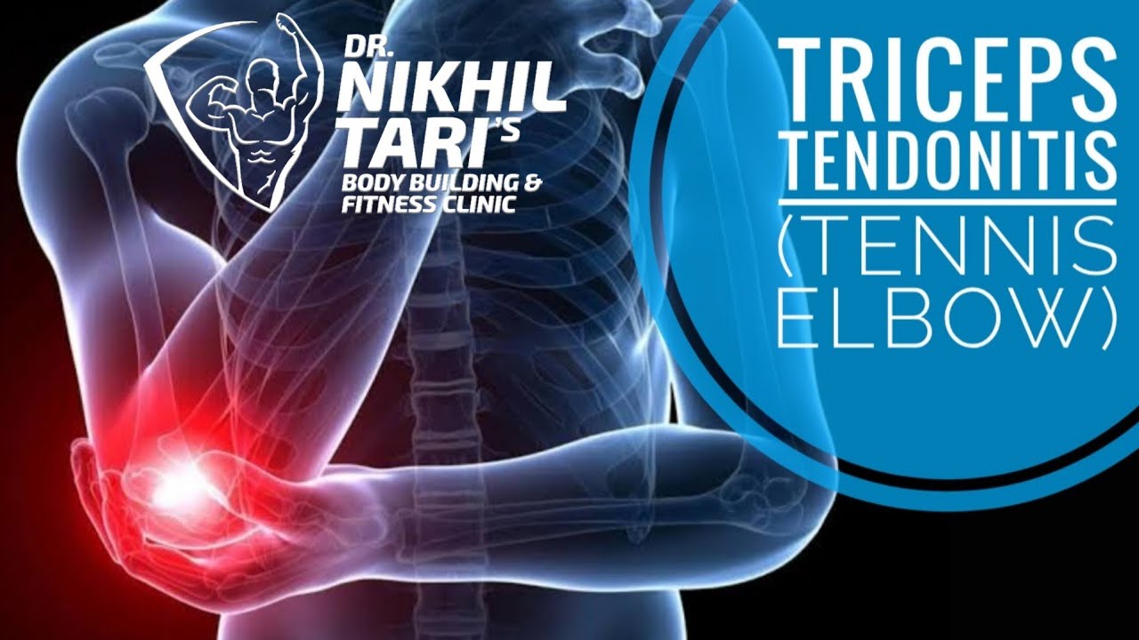 TRICEPS TENDONITIS (TENNIS ELBOW) - Dr. NIKHIL TARI'S EXPLANATION - YouTube