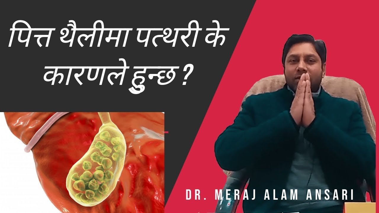 पित्तथैलीमा पत्थरी किन हुन्छ ? पत्थरी भएको कसरी थाहा पाउने ? || Dr ...