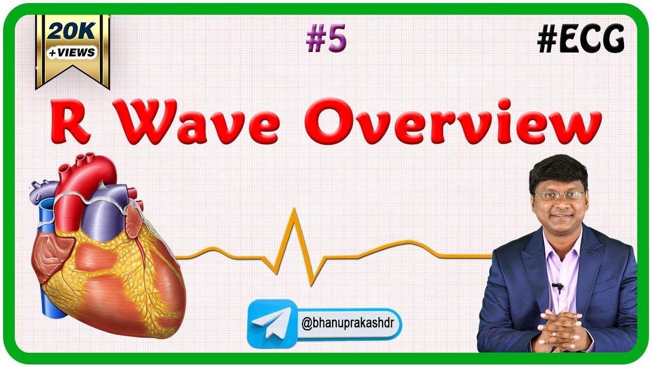 5. R Wave Overview - ECG assessment and ECG interpretation made easy ...