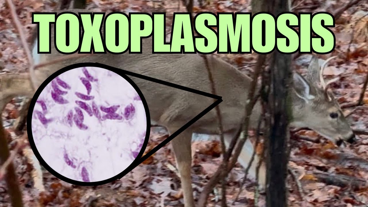 DEADLY PARASITE (TOXOPLASMOSIS) in Undercooked Venison is Incurable! Be ...