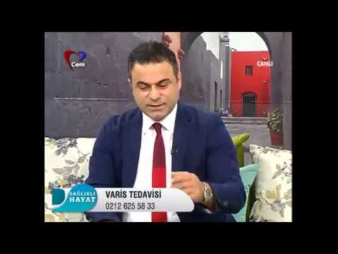 köpük ve Lazerle varis tedavisi oldum, varisim tekrarlar mı