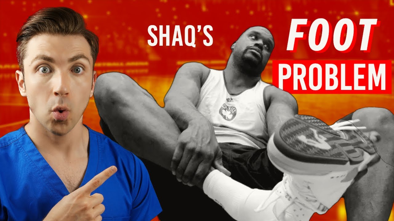 Shaq's Medical Foot Dignosis Explained (Plantar Fasciitis) - YouTube