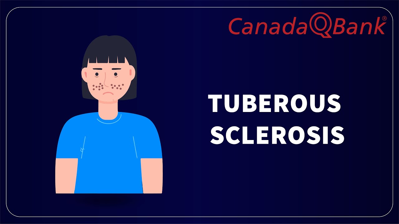 Tuberous Sclerosis: Symptoms, Genetics & Diagnosis | High-Yield Review ...