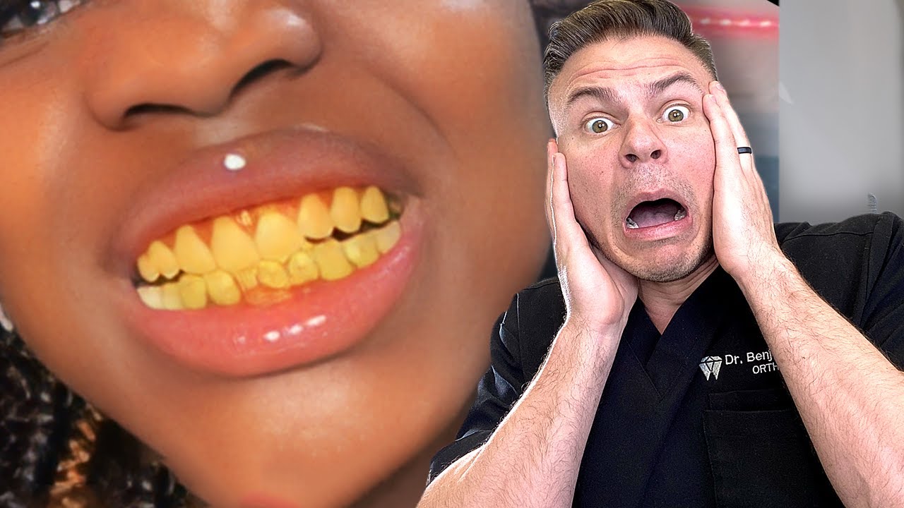 5 Things To Avoid YELLOW Teeth RIGHT NOW! 🦷😮 - YouTube