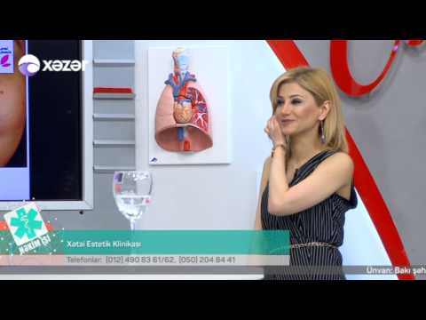 18 04 2017 Hekim ishi Xetai Estetik Klinikasi Estetik cerrah Sami Samin