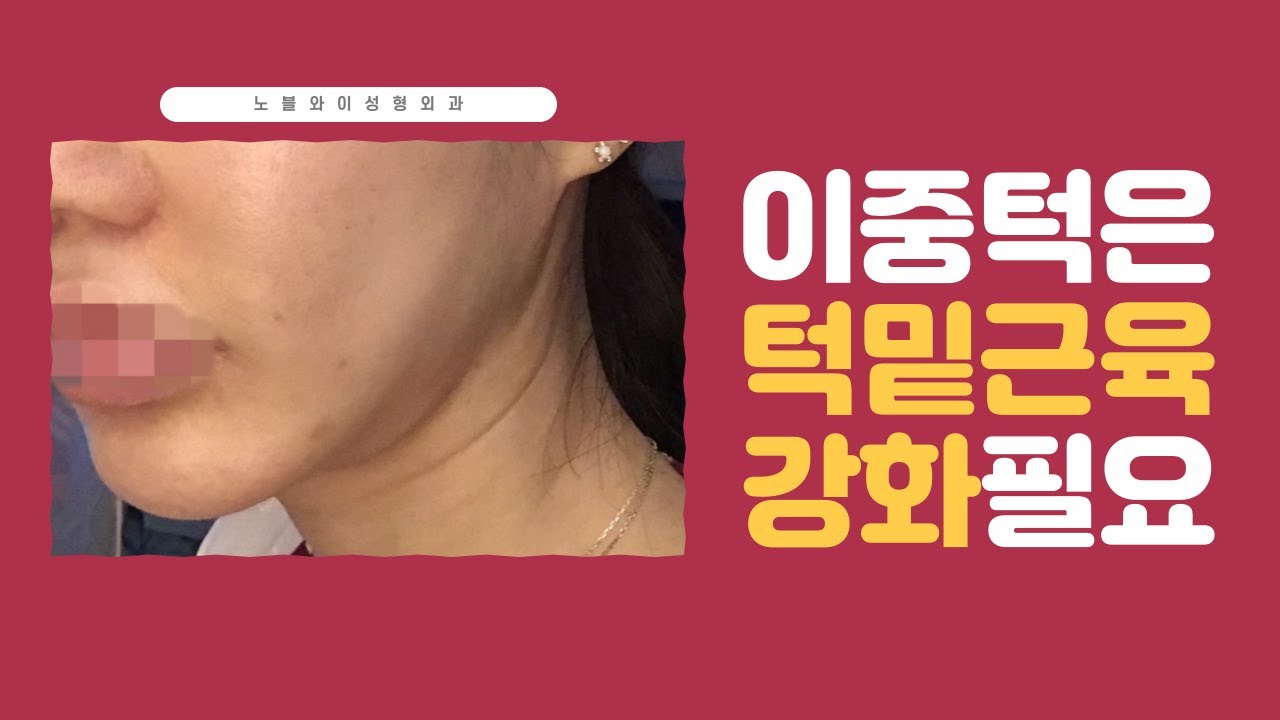 턱살 리프팅 효과 얻기 위해선 턱밑 근육 강화시켜주어야 ★더보기란 필독★ Youtube