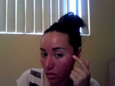Acne treatment Levulan: Day 1 - YouTube