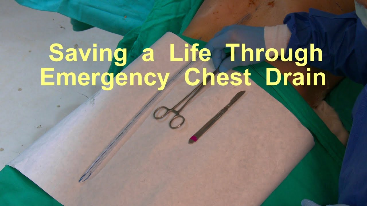 Saving a Life Through Emergency Chest Drain - YouTube