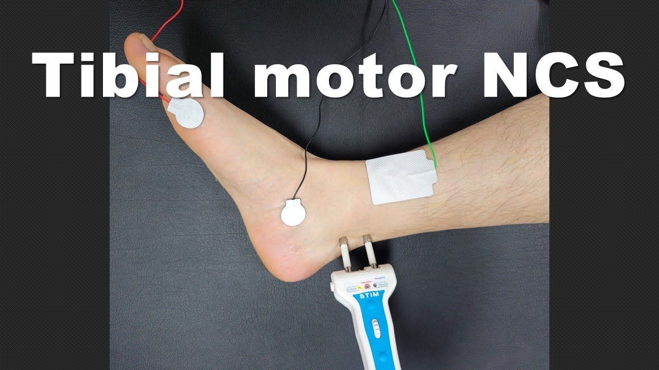 [EMG, NCS] 운동신경전도검사 - 정강신경 / MOTOR NCS - TIBIAL NERVE / 상세설명 포함 ...