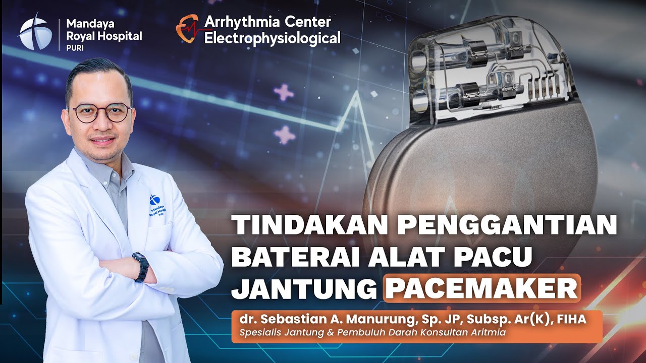 Tindakan Penggantian Baterai Alat Pacu Jantung (Pacemaker) | dr ...