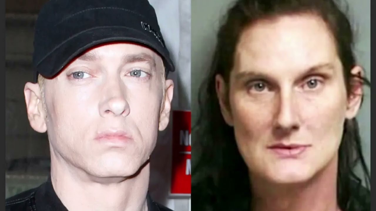 Eminem Before And After Plastic Surgery