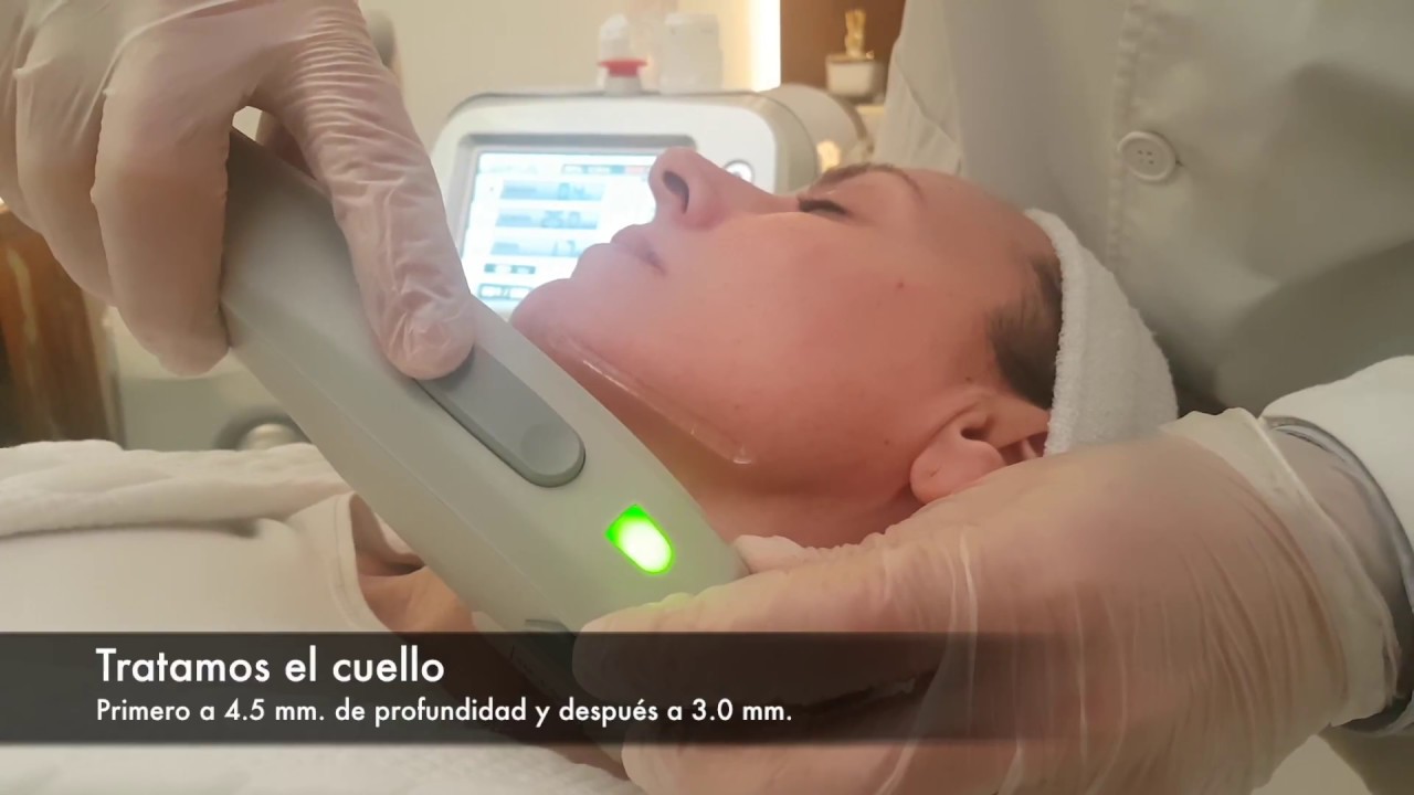 ULTRATHERAPY, Lifting facial sin cirugía HIFU - YouTube
