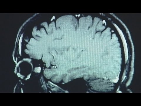 New Eye Technology Can Help Diagnose Brain Injuries Faster