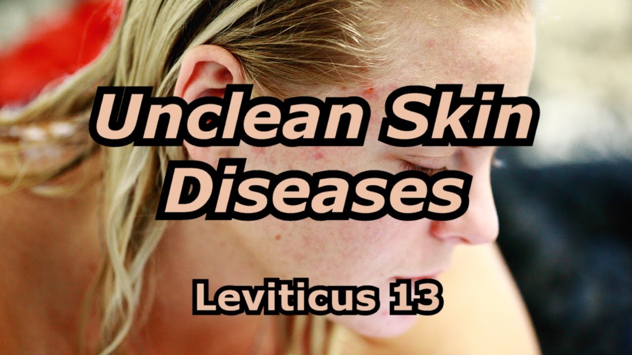 Unclean Skin Diseases (Leviticus 13) - YouTube