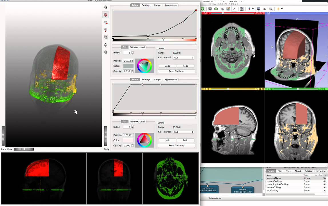 Slicer MeVisLab TagVolumeRendering 2012 09 26 - YouTube