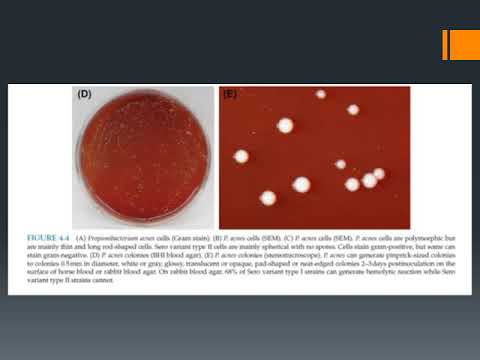 subgingival flora - YouTube