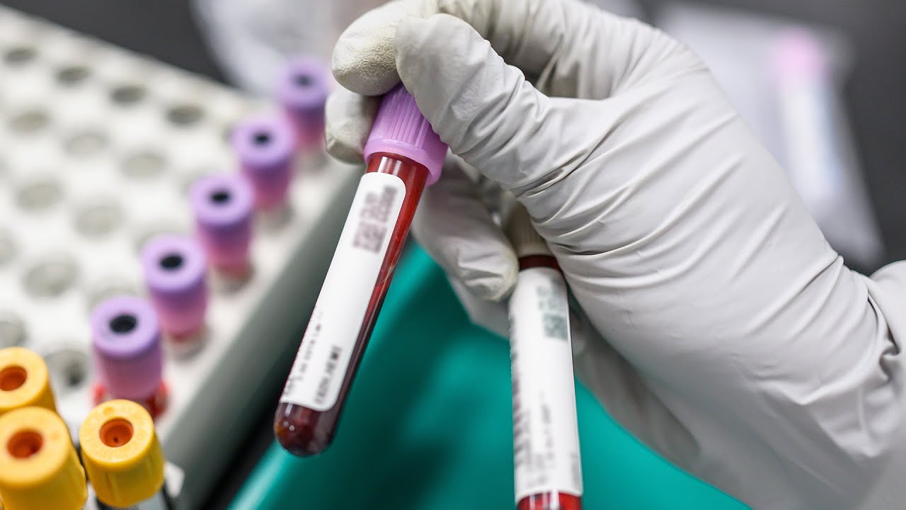 Clinical Updates on Thrombotic Thrombocytopenic Purpura (TTP) - YouTube