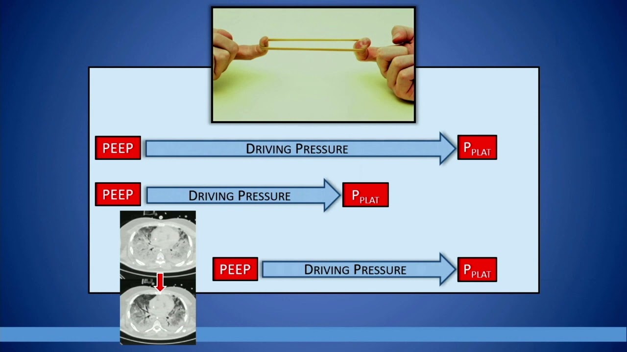 The Fundamentals of Mechanical Ventilation and Its use While on ECMO ...
