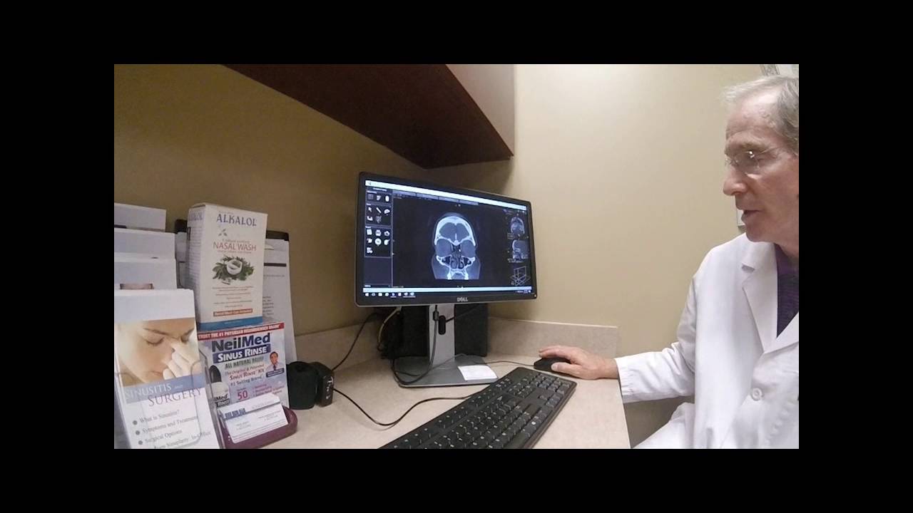 Review of a CT Scan with Dr. Simons - YouTube
