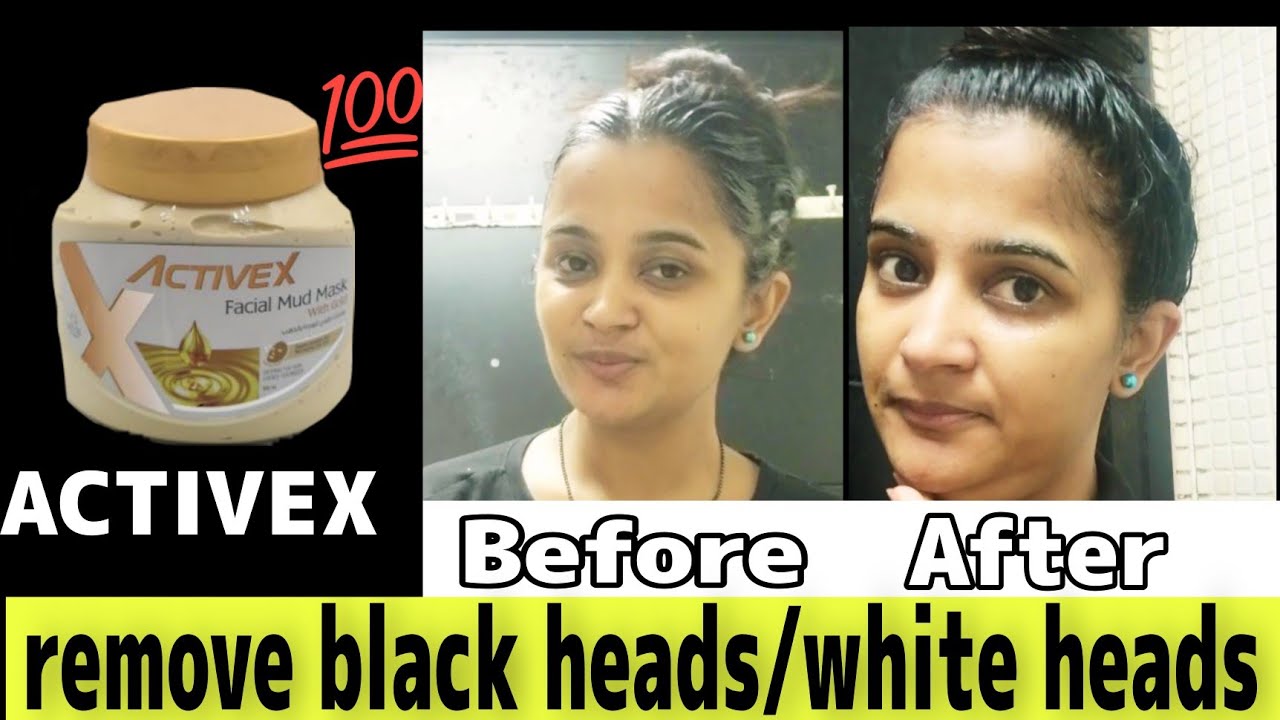 ACTIVEX / Facial Mud Mask Gold Remove BlackHeads & WhiteHeads ഒരു യൂസി ...