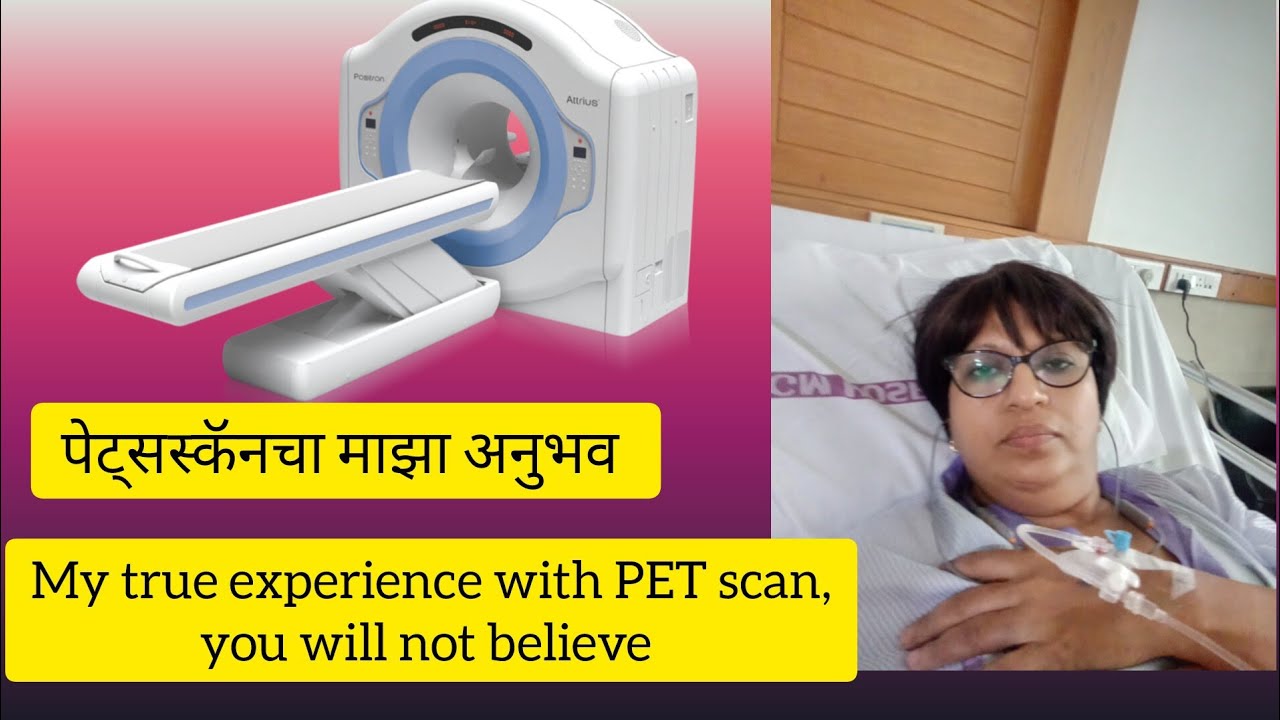 My true experience with PET scan,you will not believe it.माझा ...