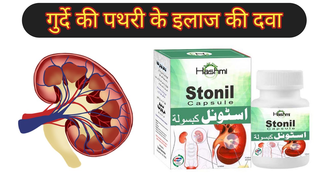 Stonil Capsule Detailed REVIEW | Effective solution for kidney stones ...