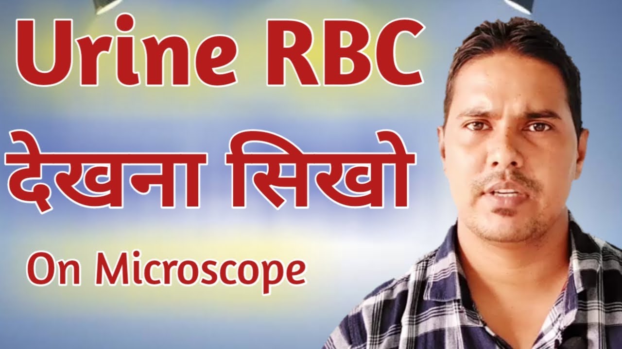 Urine rbc under microscope | How to identify urine rbc | How to count ...