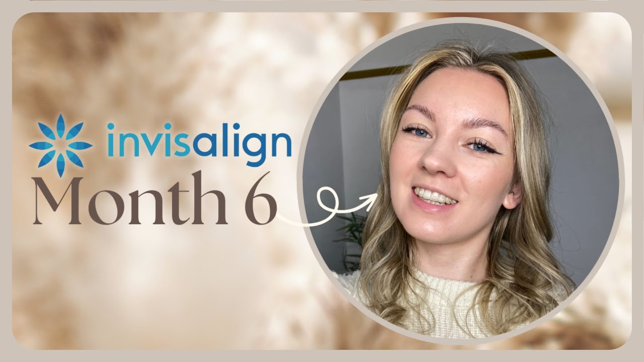 Invisalign 6 Month Review | AD PR 🦷 - YouTube